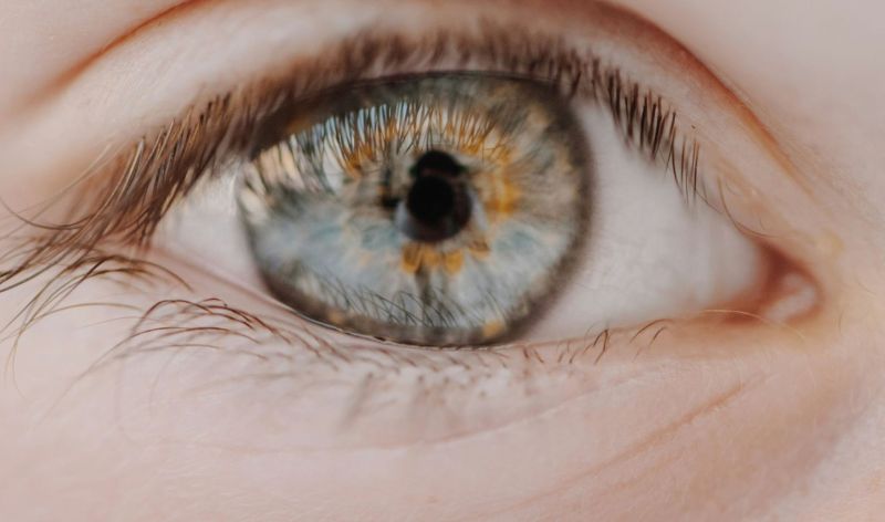 Normal Tension Glaucoma Glaucoma Friends